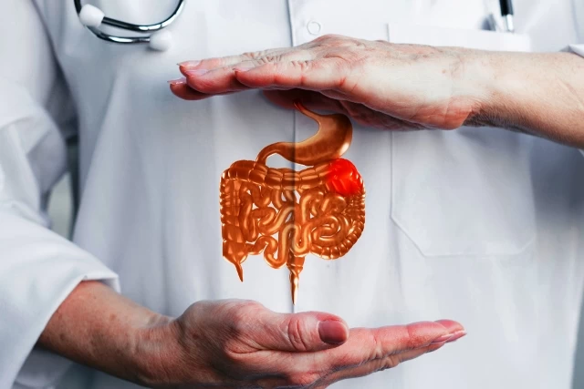 Colon Cancer - Part 2: Diagnosis and Treatment Methods - General ...