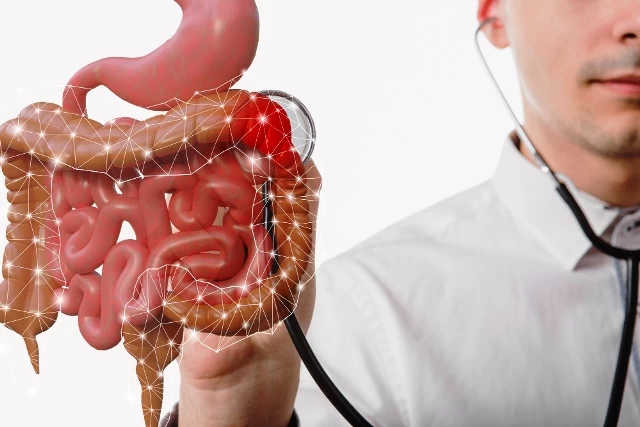 Colon Cancer - Part 3: Rehabilitation and Preventive Measures - General ...